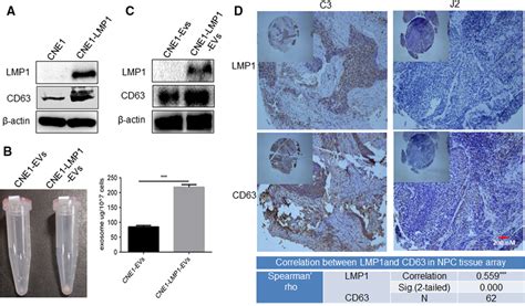 Lmp1 Promotes The Secretion Of Extracellular Vesicles Evs Containing