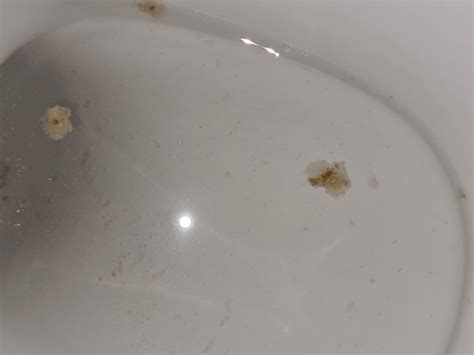 Passed This In My Stool Help Identifying Rbiofilms