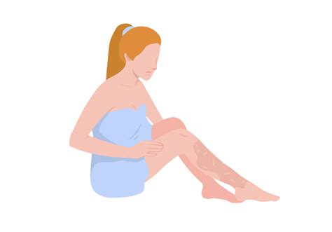 Cellulitis Upper Leg