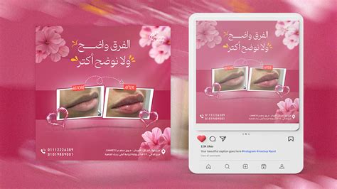 Dr Mariam Hamdy Social Media Posts 6 Images Behance