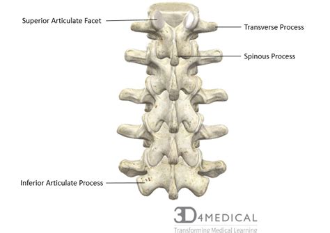 Lumbar Spine Transverse Process Fracture Everything You Need To Know
