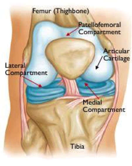 Why Have A Knee Replacement