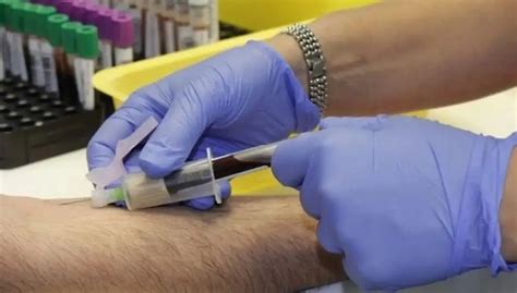 ¿quiénes Pueden Donar Sangre Estos Son Los Requisitos Xeu Noticias