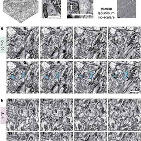 3d Serial Block Face Scanning Electron Microscopy Of Dendritic Spines