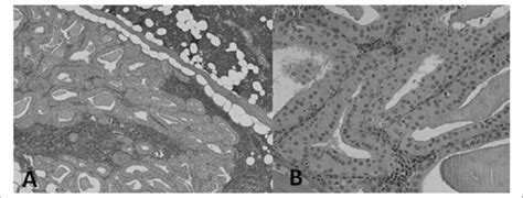 A Histologic Examination Of Hematoxylin And Eosin Stained Slides