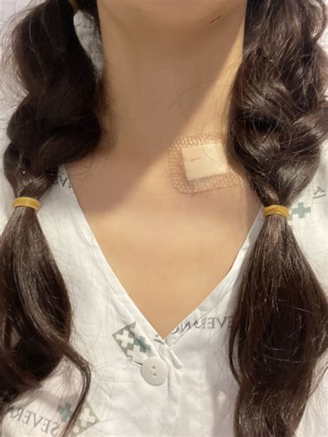 갑상선암 수술 후기 신촌세브란스 남기현 교수님 수술 후 2년 네이버 블로그