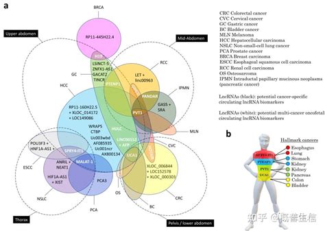 医学数据挖掘：癌症早筛的希望—lncrna 知乎