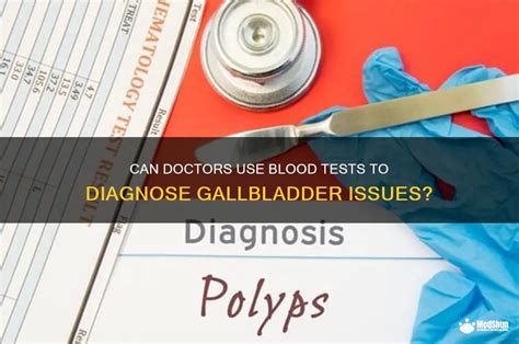 Can Doctors Use Blood Tests To Diagnose Gallbladder Issues Medshun