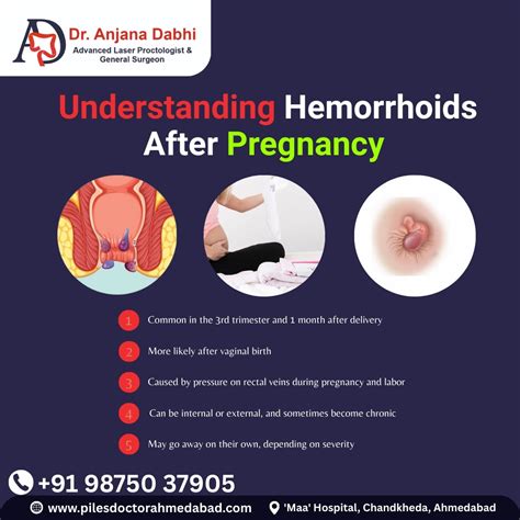 External Hemorrhoids In Pregnancy Treatment