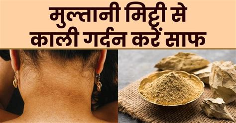 Kali Gardan Kaise Saaf Karen कल गरदन क 10 मनट म गर कर सकत
