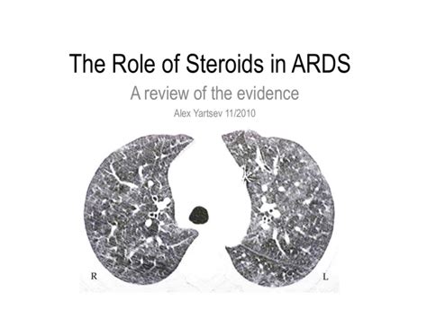 The Role Of Steroids In Ards