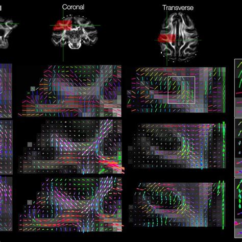 The Hybrid Dmri Pli Fibre Orientations Top Right The Angular