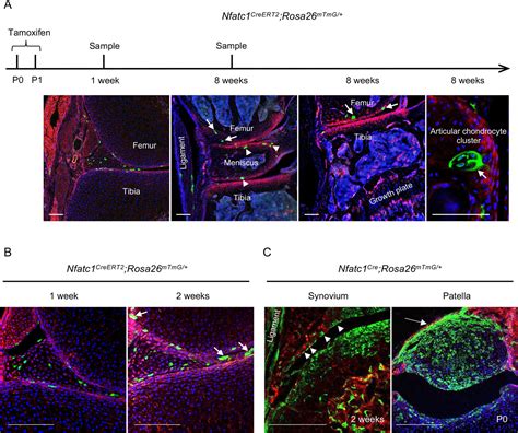 NFATc1 Marks Articular Cartilage Progenitors And Negatively Determines