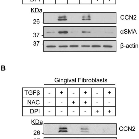 Tgfβ1 Induced Ccn2 And αsma Protein Expression In Human Dermal And