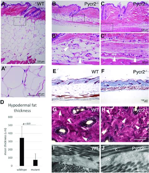 Skin Phenotypes In Pycr2 À À Mice A Control Mice Have A Thick