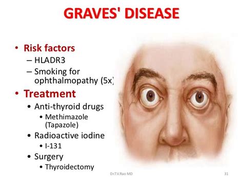 Grave Thyroid Disease Symptoms