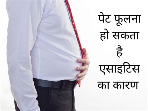 पेट फूलने की समस्या नहीं है आम जानिए एसाइटिस बीमारी के लक्षण और इससे