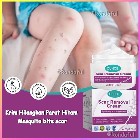 Krim Hilangkan Parut Hitam Mosquito Bite Scar Repair Old Scars Scald