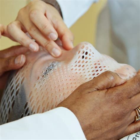 Radiation Burns How To Cope With Radiation Burns The Patient Story