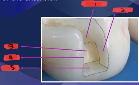 Op Final Flashcards Quizlet