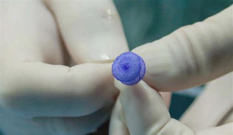 全降解封堵器：植入无残留！创新产品助力先心病患儿实现更大获益 知乎