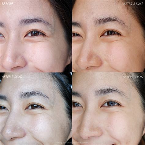 ห้องเรียน Skindex สกินแคร์และการดูแลผิว รักใครให้สกินแคร์ ปีใหม่