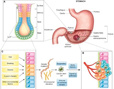The Development Of Gastric Cancer As Induced By H Pylori And Other Download Scientific Diagram