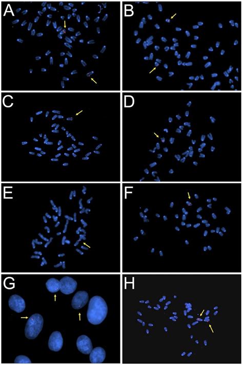 Fluorescent In Situ Hybridisation Study On Fibroblasts Probed With