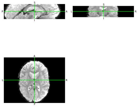 Python 讀取、顯示 Nifti 影像教學與範例 Office 指南