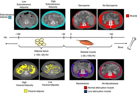 Muscle And Adipose Tissue Quantification For Identification Of Body