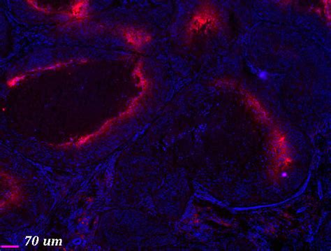 Hypoxyprobe 한국공식대리점 메디코 Medico