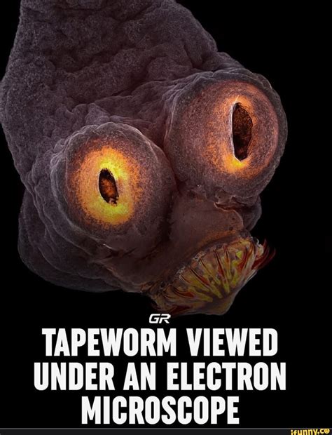 Tapeworm Viewed Under An Electron Microscope Ifunny