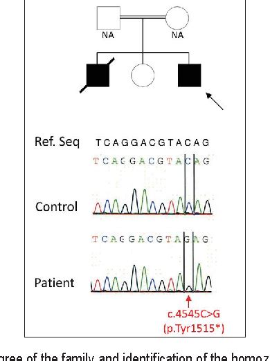 Figure 1 From The Most Frequent Abca3 Nonsense Mutation P Tyr1515 Y1515x Causing Lethal