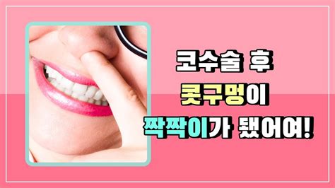 코수술 후 콧구멍이 짝짝이가 됐어여 Youtube