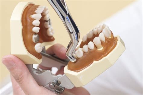 Wisdom Teeth Removal Recovery Timeline
