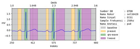 python how can i make certain annotations display in wfdb stack