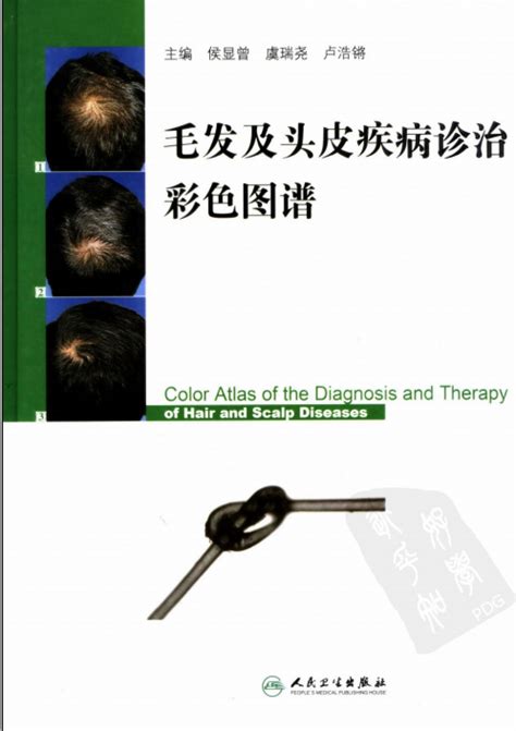 毛发及头皮疾病诊治彩色图谱下载医学电子书