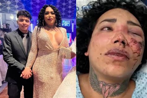 Paola Suárez rompe el silencio tras haber sido golpeada por su pareja