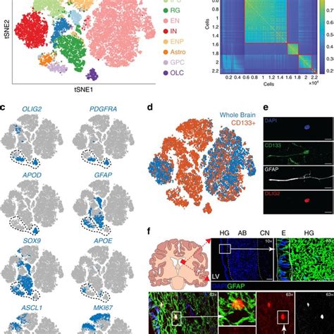 Single Cell Rna Sequencing Highlights Transcriptomic Heterogeneity In