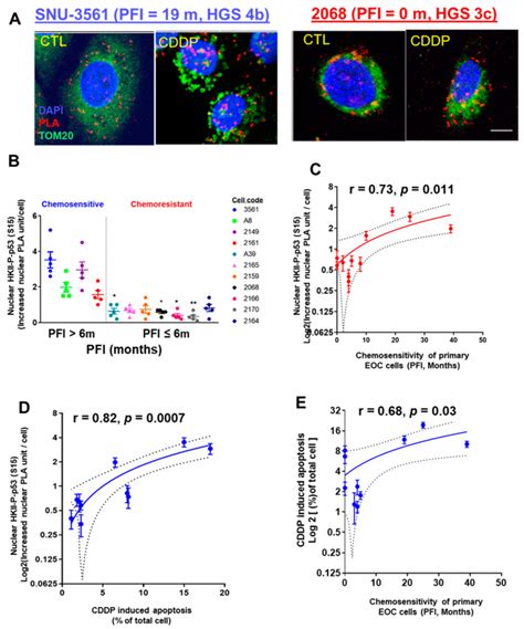 Nuclear Hkii P P53 Ser15 Interaction Is A Prognostic Biomarker For