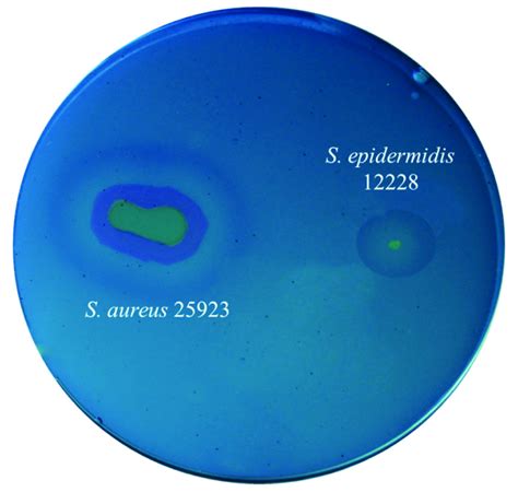Evaluation Of Hiaureustm Coagulase Confirmation Kit In Identification Of Staphylococcus Aureus Pmc