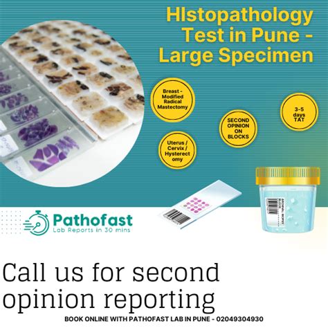 Histopathology Large Specimen In Puneprice Symptoms Normal Range
