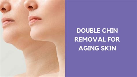 Ppt Double Chin Removal For Aging Skin Powerpoint Presentation Free