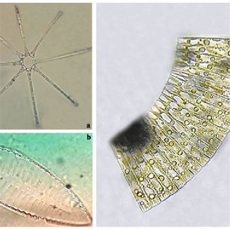 3 Representatives Of Cyanophyceae In Eutrophic Waters A Microcystis