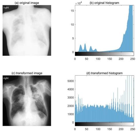 Balanced Convolutional Neural Networks For Pneumoconiosis Detection
