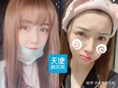 孙一宁和王思聪的初恋：长成什么样才能征服王思聪？ 知乎