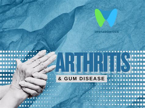 Rheumatoid Arthritis And Gum Disease In Depth Exploration Instadontics