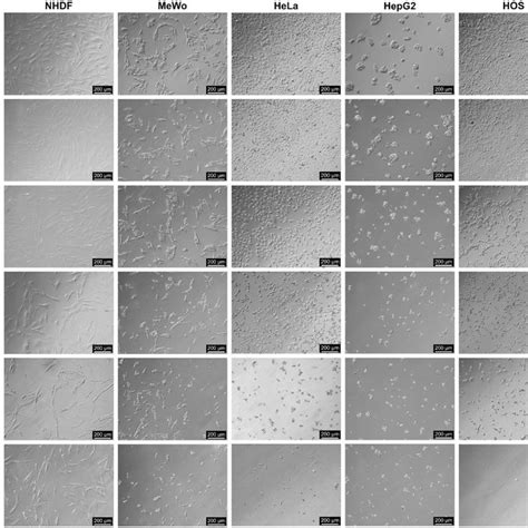 Morphological Analysis Of Normal Dermal Fibroblasts Nhdf Malignant