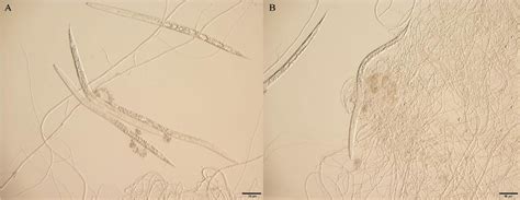 Frontiers Virulent And Attenuated Strains Of Trichoderma