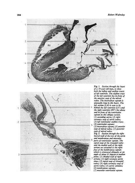 Solution Anatomy Of Left Ventricular Outflow Tract Studypool
